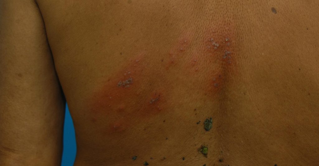 Kayap – Klinik Putra